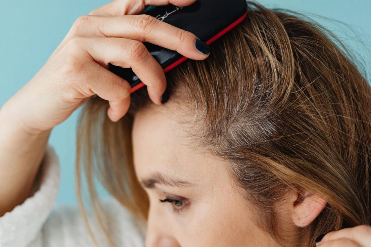 How to Fix a Receding Hairline | PHRC
